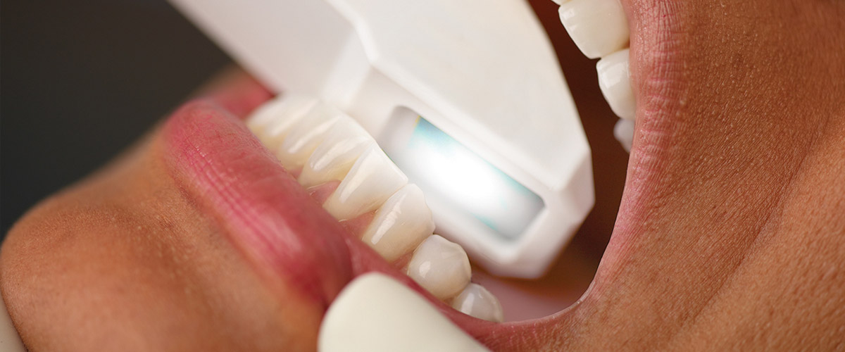 Hopkinson Orthodontics header-scanner
